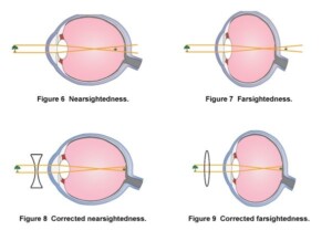 Human Eye Optics