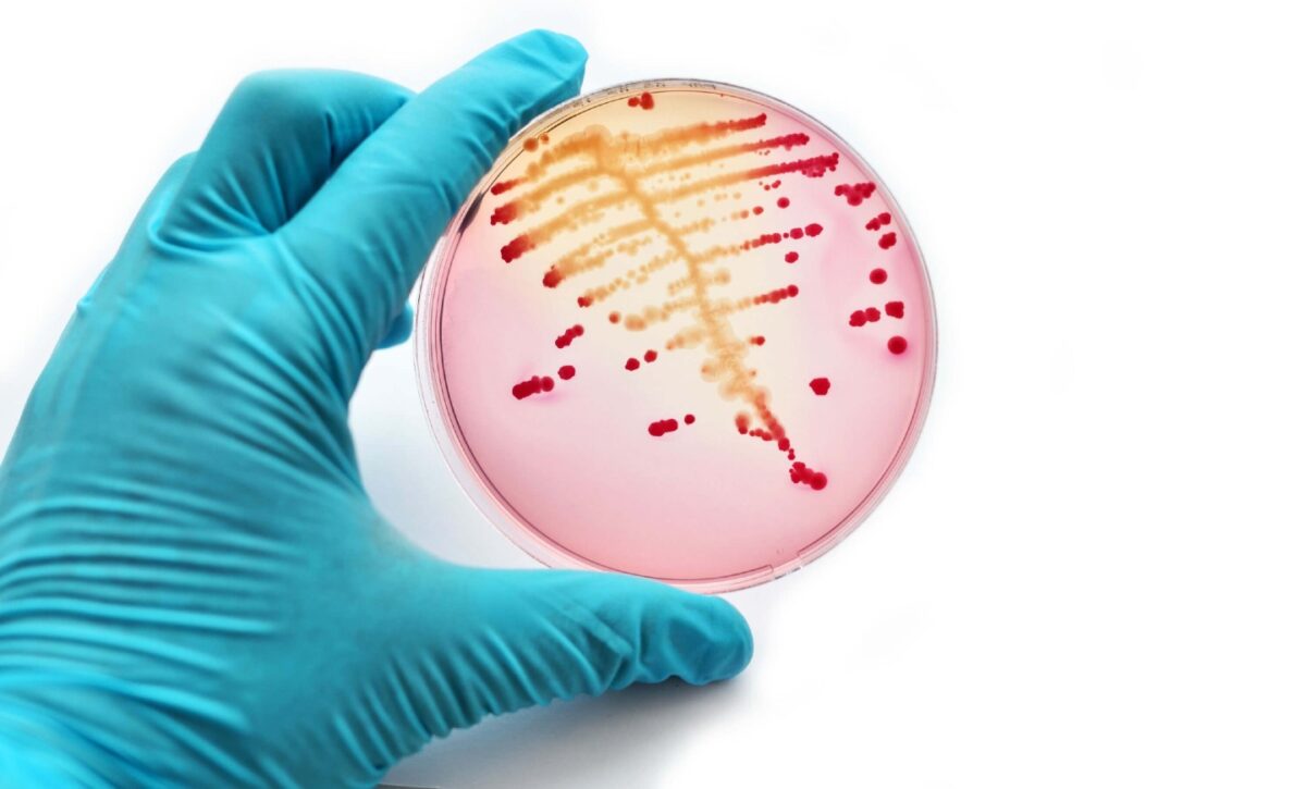 Safe Microbiology Practices