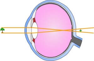 Human Eye Optics