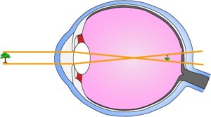 Human Eye Optics