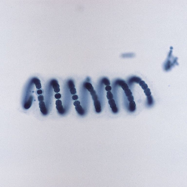 Introduction to Protists: Euglena - Carolina Knowledge Center