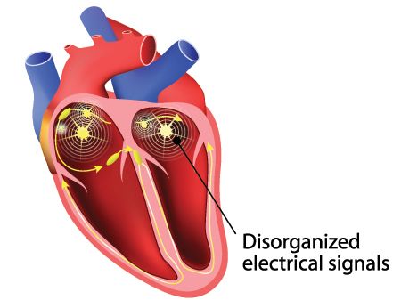 Teaching the Cardiovascular System